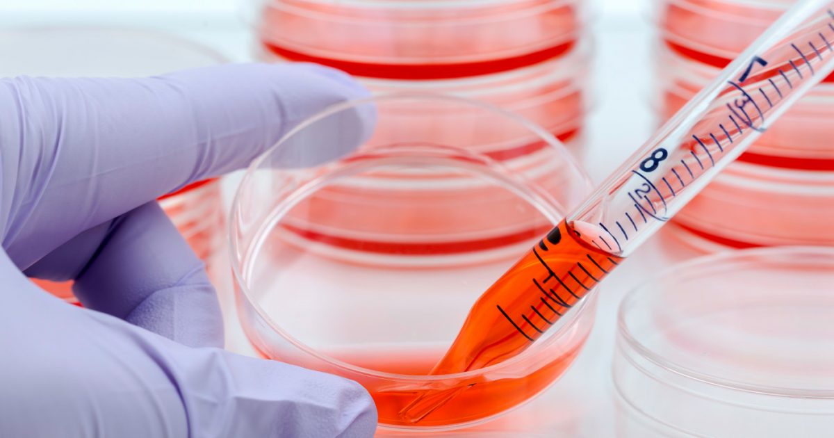 PH Blood Vessel Remodeling Linked to LRP1 Protein Levels, Study Shows