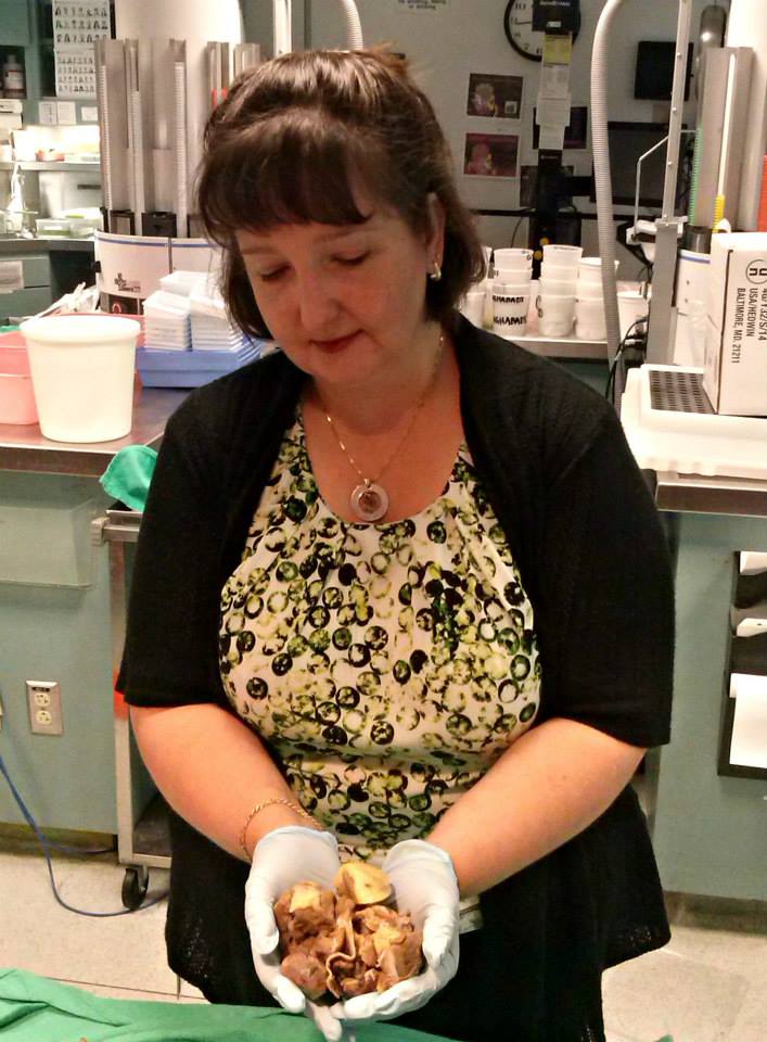 Finding Closure in the Gross Lab | Pulmonary Hypertension News